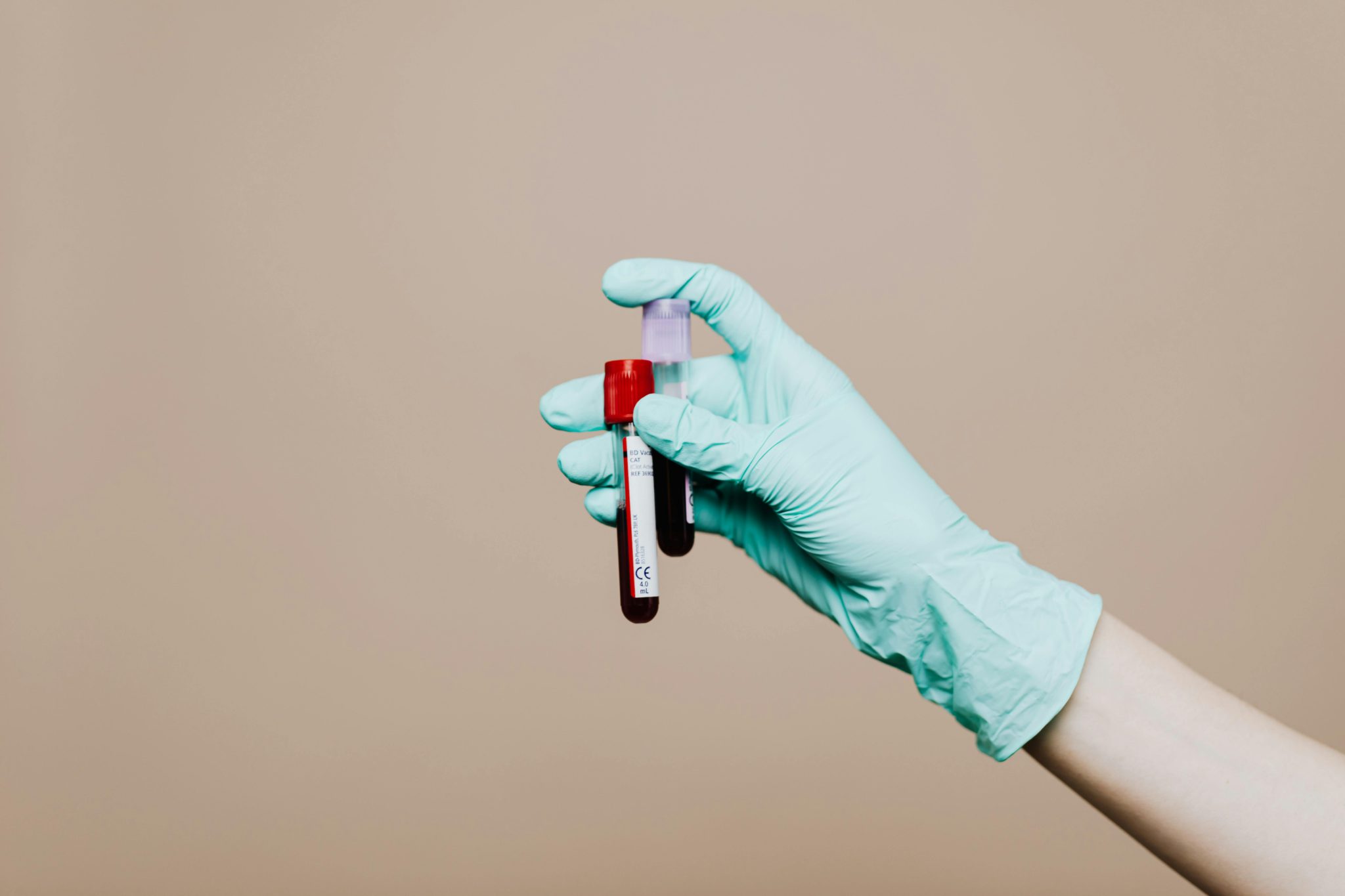 Blood Urea Nitrogen Test: Everything You Need to Know - Speedy Sticks ...