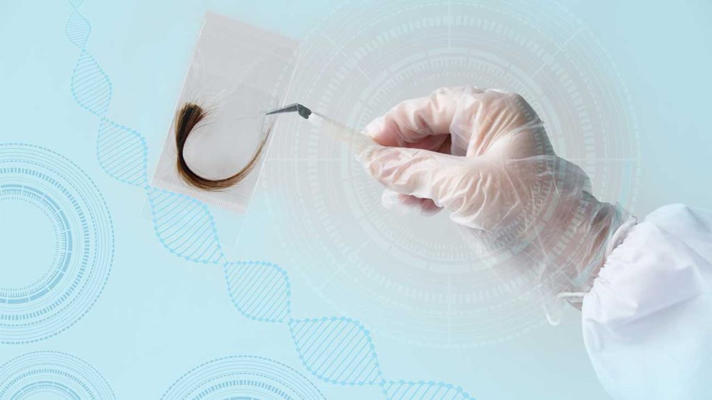 Hair Follicle Drug Test: Everything You Need to Know - Speedy Sticks ...