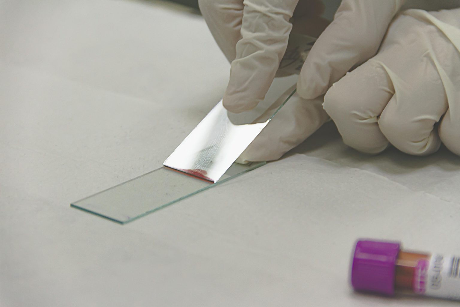 How Often You Should Get Bloodwork Done | Speedy Sticks