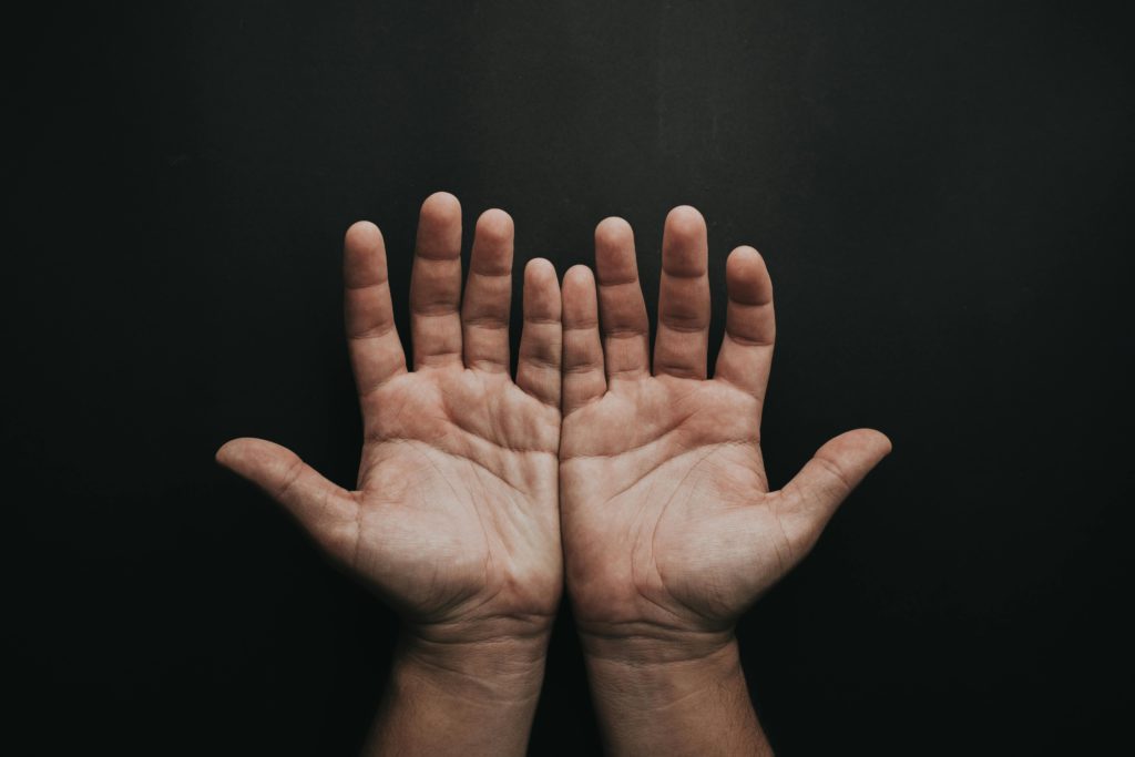 Why Are My Hands Always Sweaty? The Surprising Truth You Need to Know ...