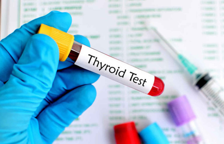 Thyroid Panel Test: A Comprehensive Guide to Thyroid Health - Speedy ...